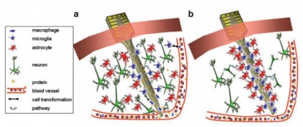 Brain-computer interface - VR & AR Wiki - Virtual Reality & Augmented ...